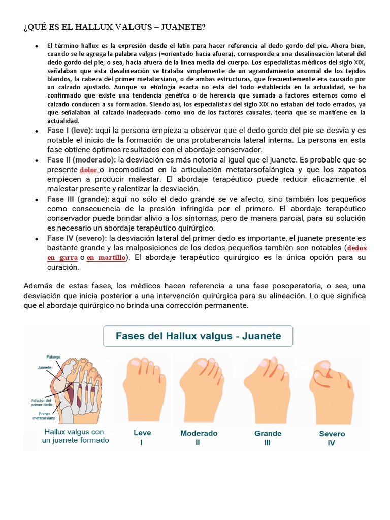Qué Es El Hallux Valgus | PDF