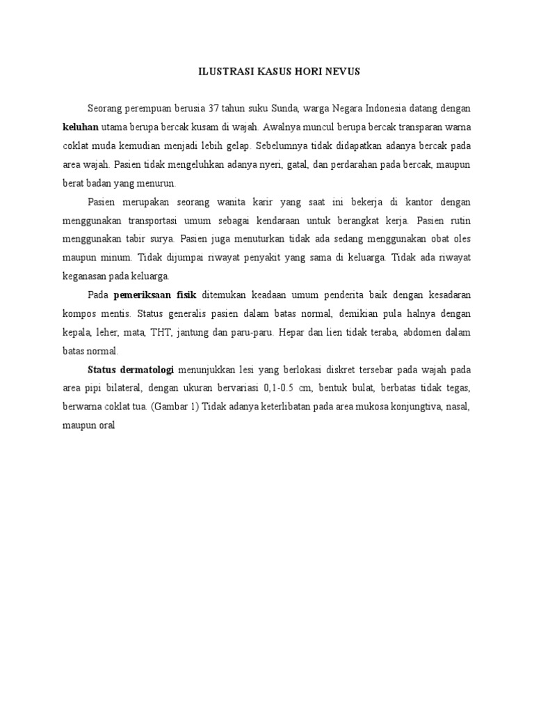 Kasus Hori Nevus pada Wanita Karir | PDF