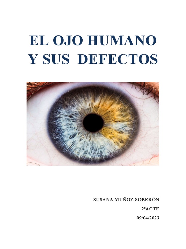 El Ojo Humano y Sus Defectos | PDF