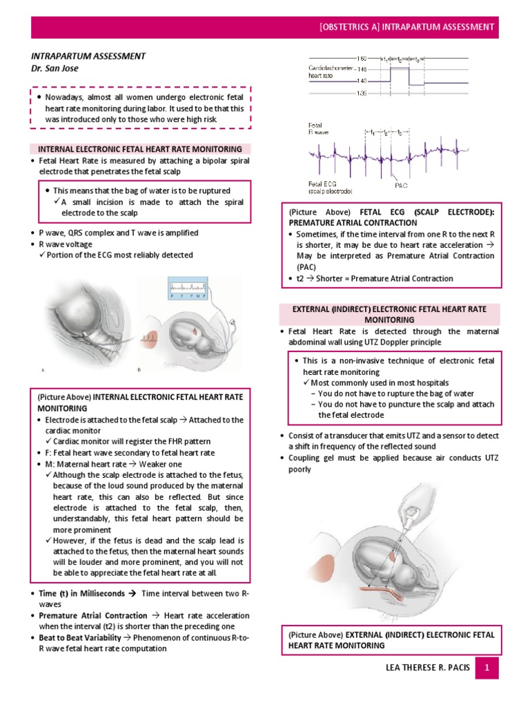 Intrapartum Fetal Heart Monitoring | PDF | Heart Rate | Heart