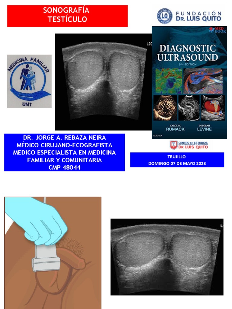 Ecografía Escrotal: Anatomía y Evaluación | PDF | Testículo | Medicina ...