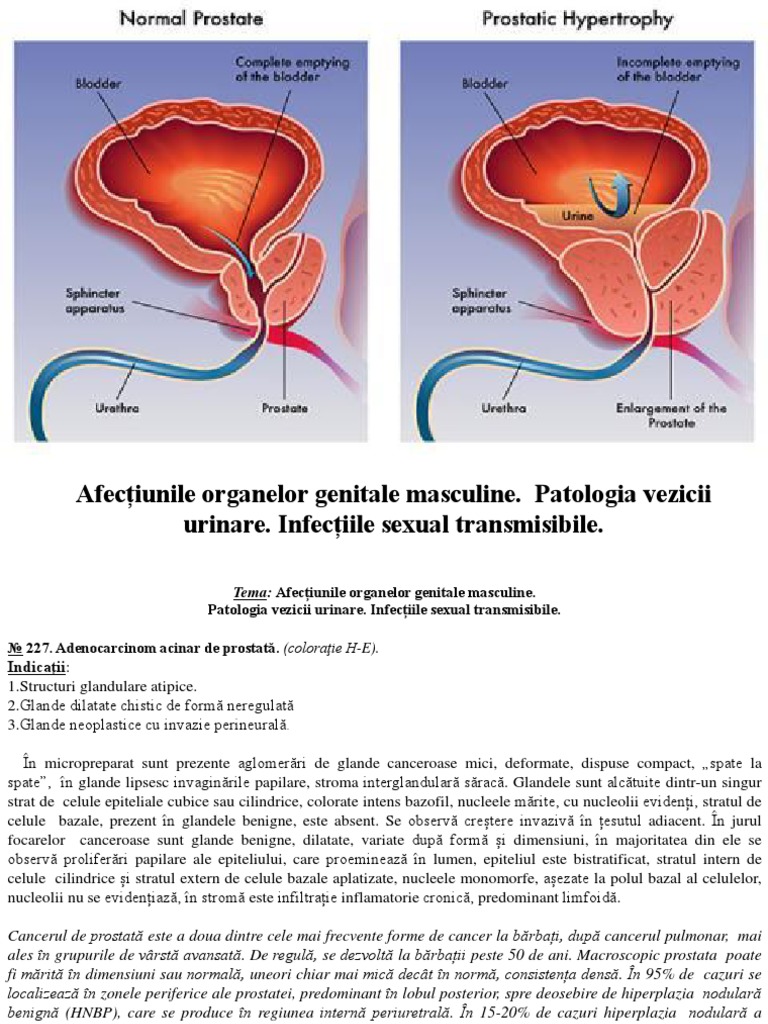 7. Afecțiunile organelor genitale masculine. (1) | PDF