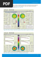 Alcon Acrysof Iol Product Catalog | PDF | Visual System | Optics