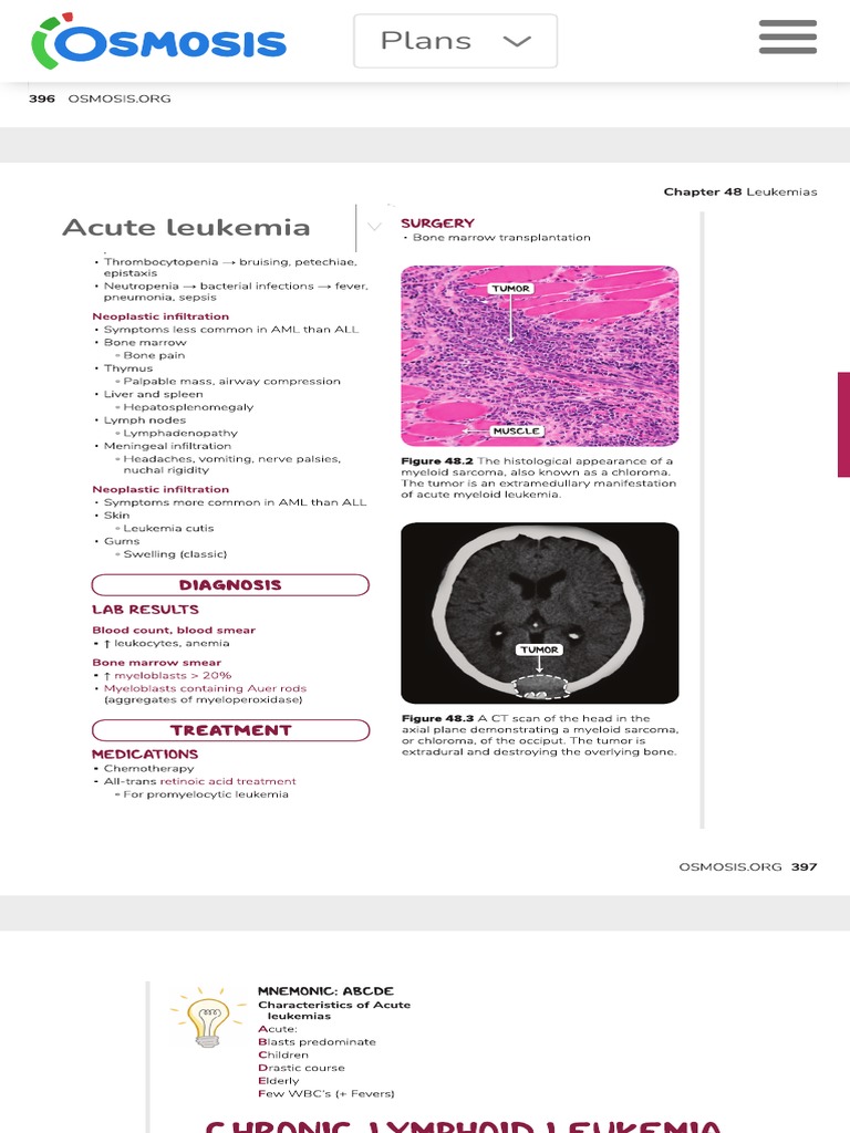 Leukemias Notes Diagrams & Illustrations Osmosis | PDF
