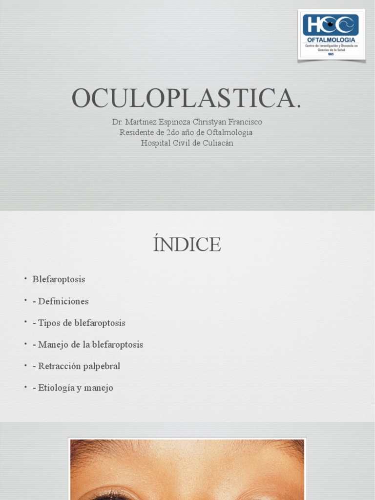 Blefaroptosis | PDF | Causas de la muerte | Ojo humano