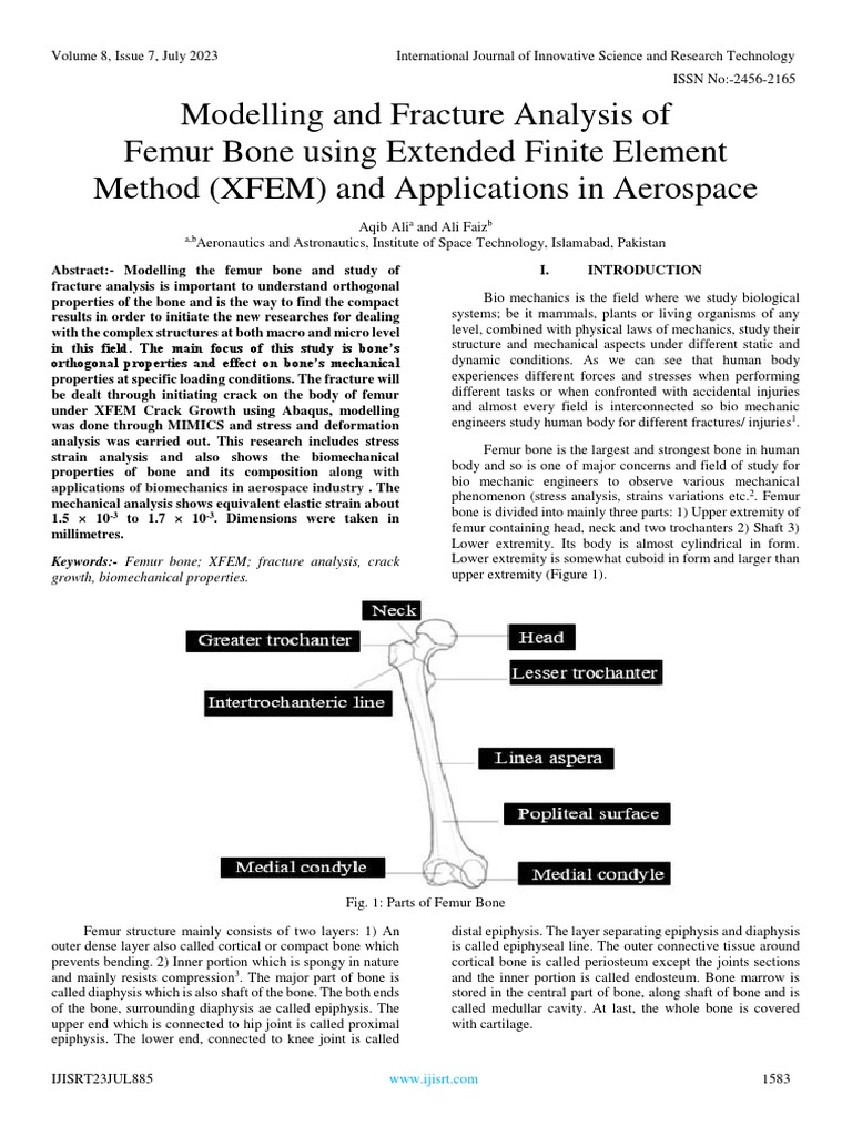 Modelling And Fracture Analysis Of Femur Bone Using Extended Finite