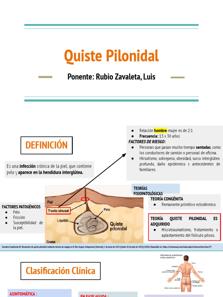 Quiste Pilonidal | PDF