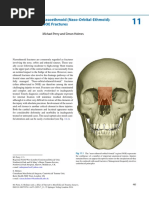 Ethmoid Bone - Location - Structure - Relationships - TeachMeAnatomy | PDF | Human Nose | Human ...