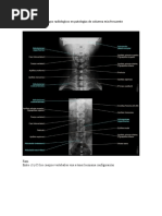 Osteofitos y su Impacto Clínico | PDF | Hueso | Sistema musculoesquelético
