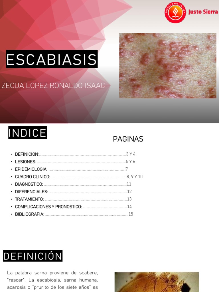 ESCABIASIS | PDF