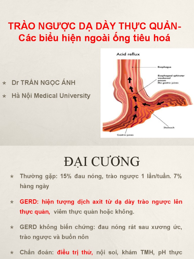 Trao Nguoc Da Day Thuc Quan - DR Ngoc Anh | PDF