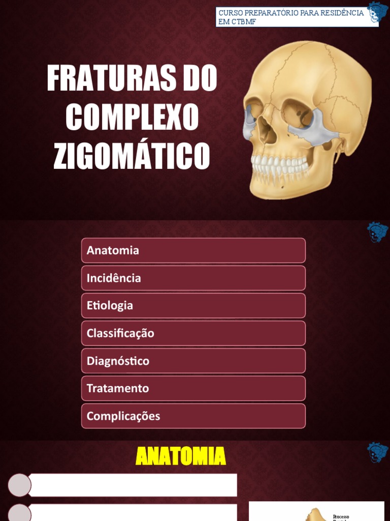 5. Fraturas de Zigoma (1) | PDF