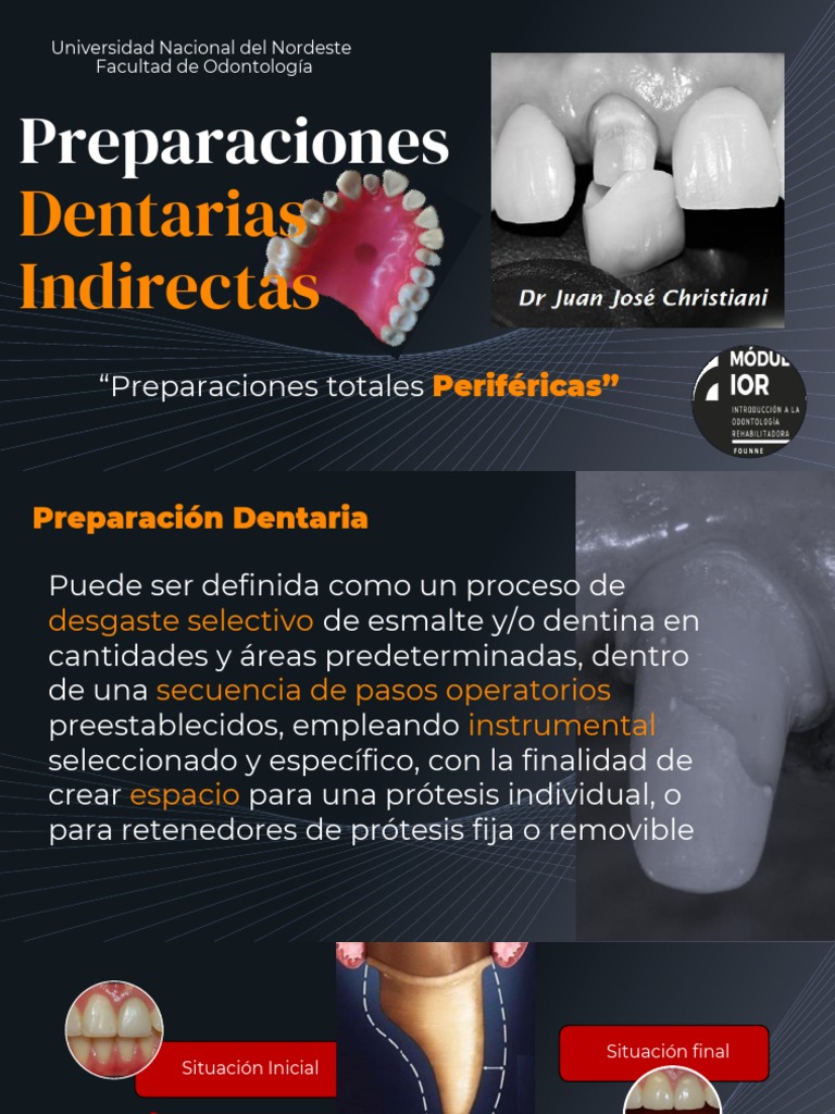 20-5 Prep. Dent. Indirectas - Sector Anterior - Share | PDF | Dentadura postiza | Odontología