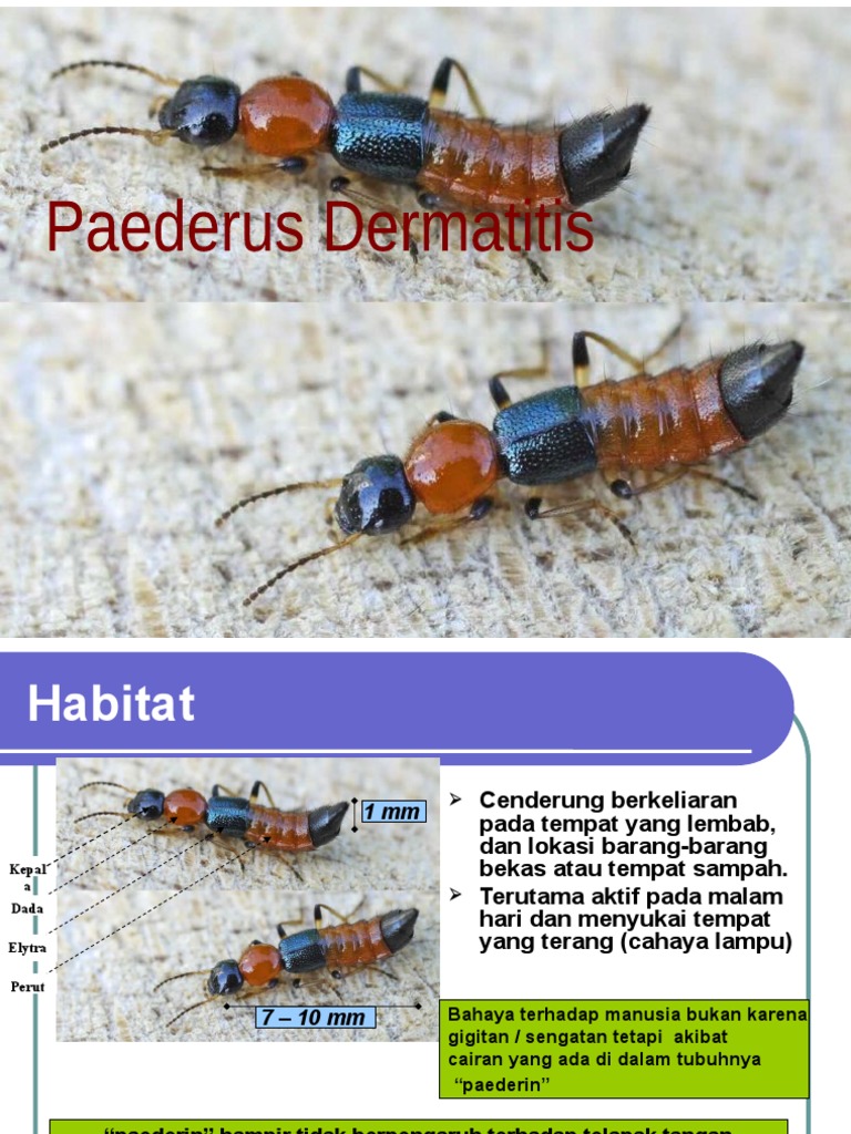 Paederus Dermatitis | PDF