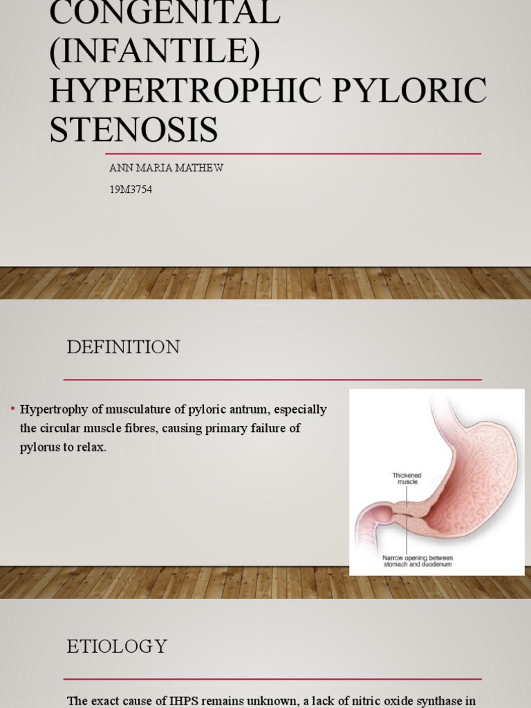 Surgery Sem - Cong Hypertrophic Pyloric Stenosis | PDF ...