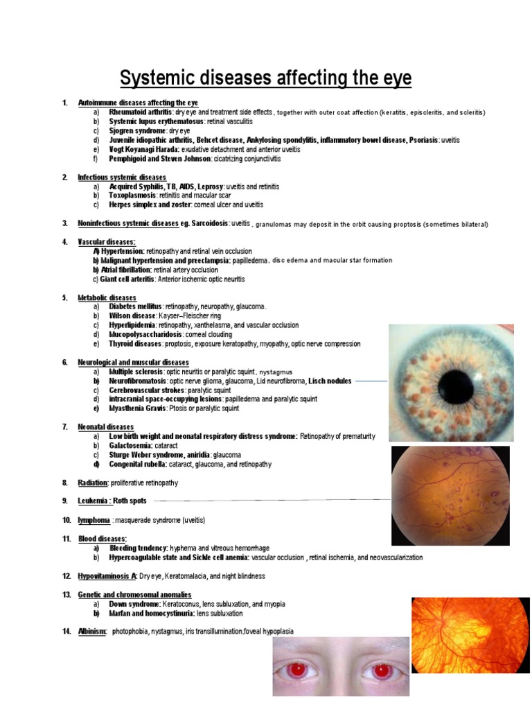 Systemic Eye Diseases Overview | PDF | Vision | Human Eye