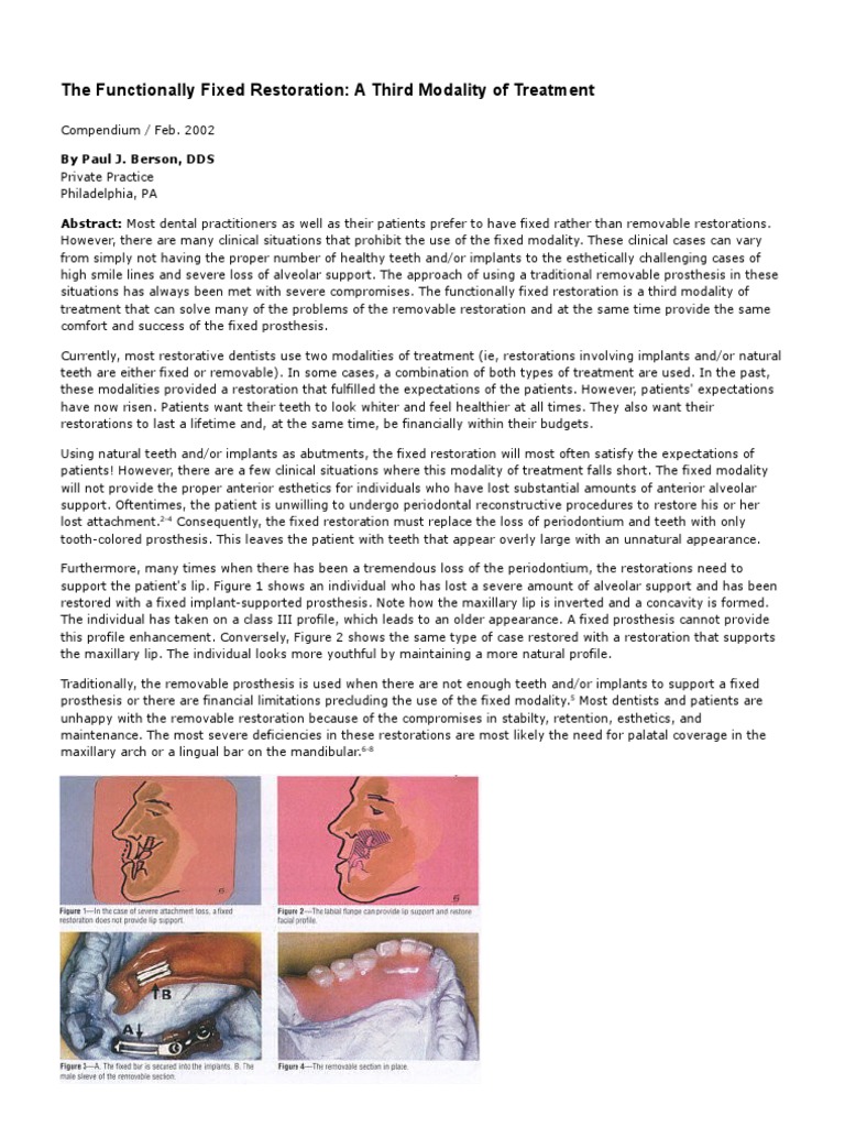 The Functionally Fixed Restoration | PDF | Dental Implant | Human Tooth