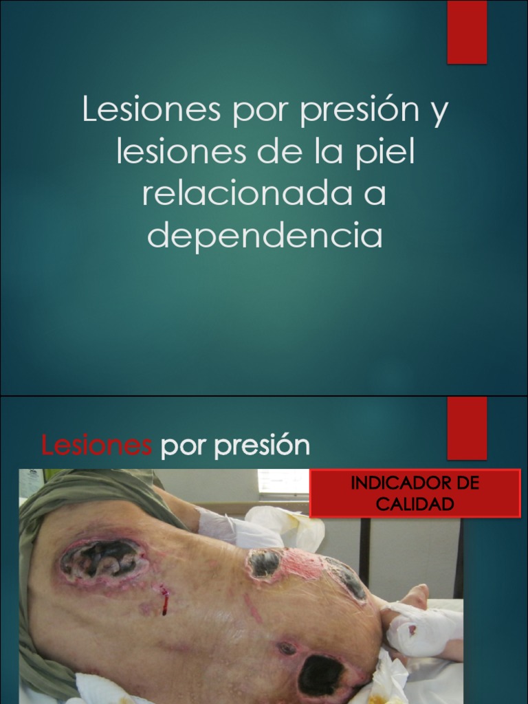 Lesiones por presión: prevención y tratamiento | PDF | Herida | Capilar