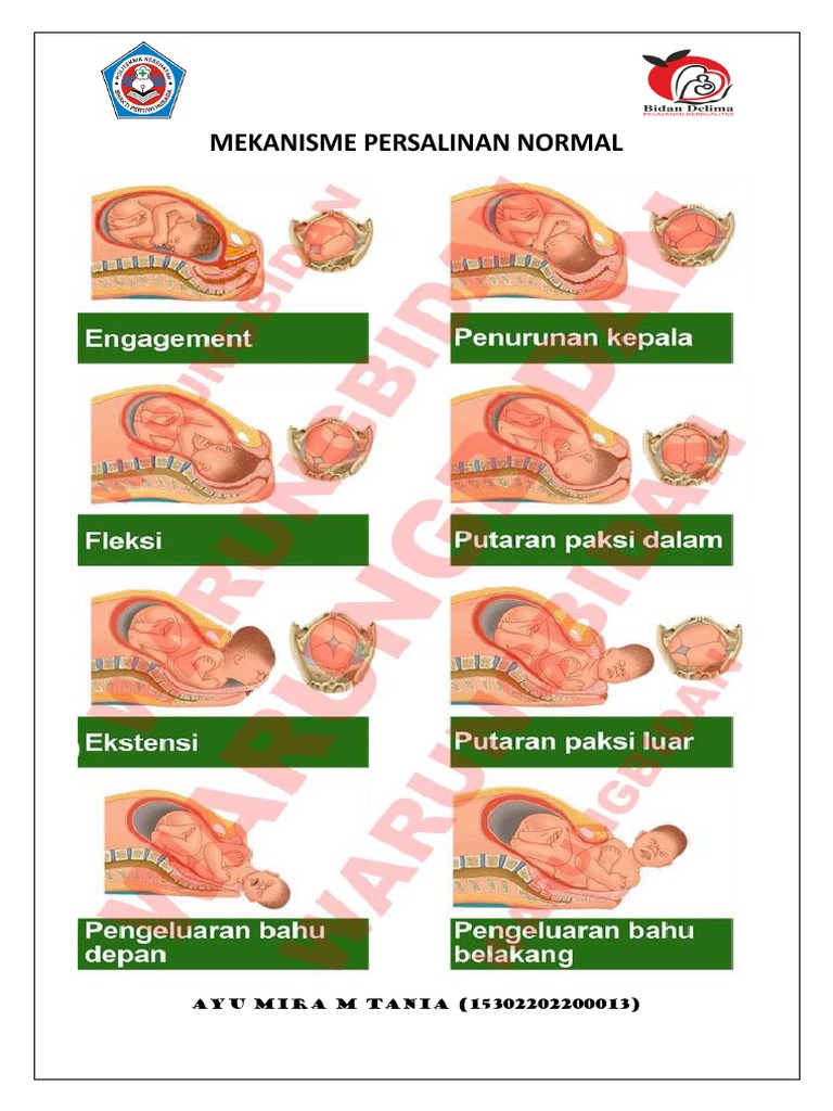 Poster Mekanisme Persalinan Normal | PDF