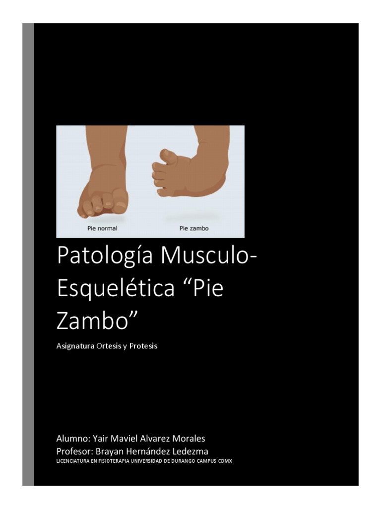 Articulo Pie Zambo | PDF | Pie | Anatomía humana