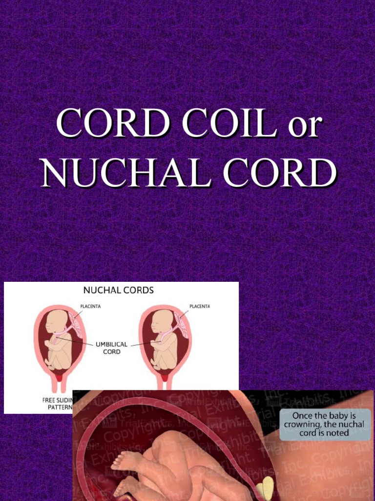 Cord Coil Lecture 1 | PDF