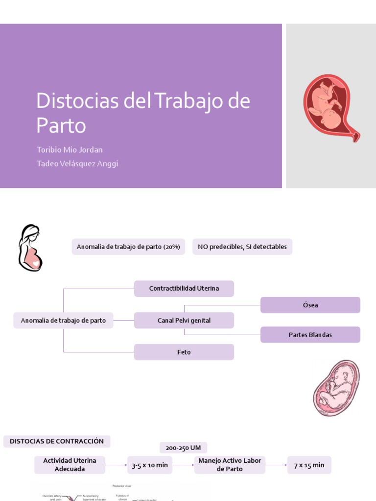 Distocias Del Trabajo de Parto | PDF | Parto | Vagina