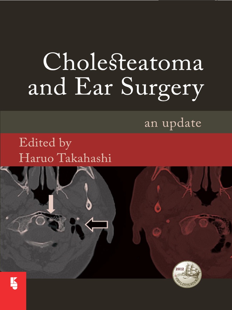 Cholesteatoma and Ear Surgery | PDF | Audiology | Human Anatomy