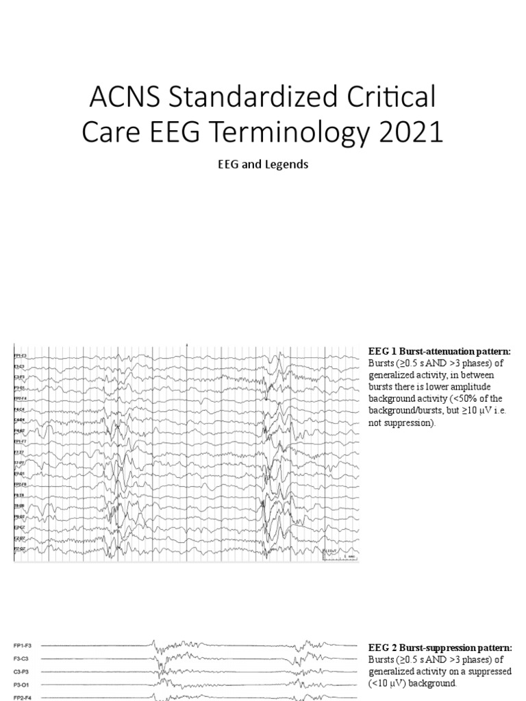 ACNS Standardized Critical Care EEG Examples 2021 | PDF | Electroencephalography | Neuroimaging