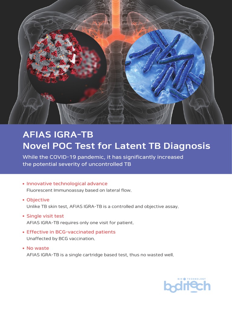 Afias Igra-Tb | PDF