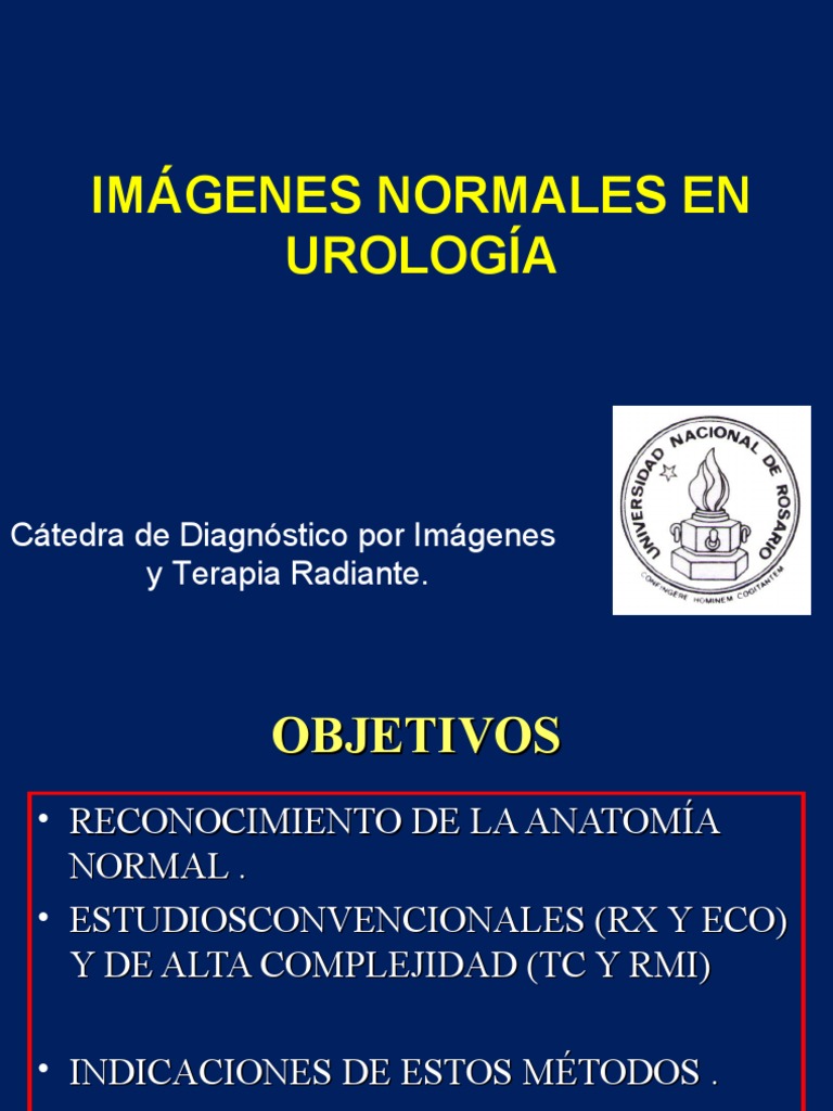 UP 8 Urinario Normal | PDF | Riñón | Imagen de resonancia magnética