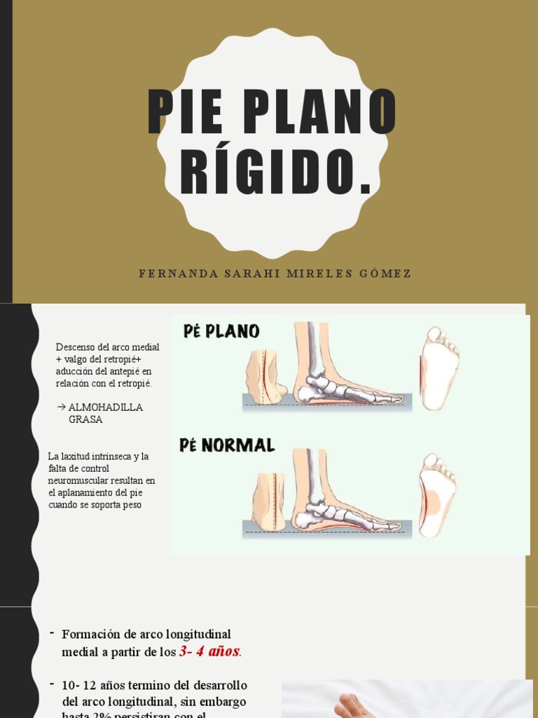Pie Plano Rigido | PDF
