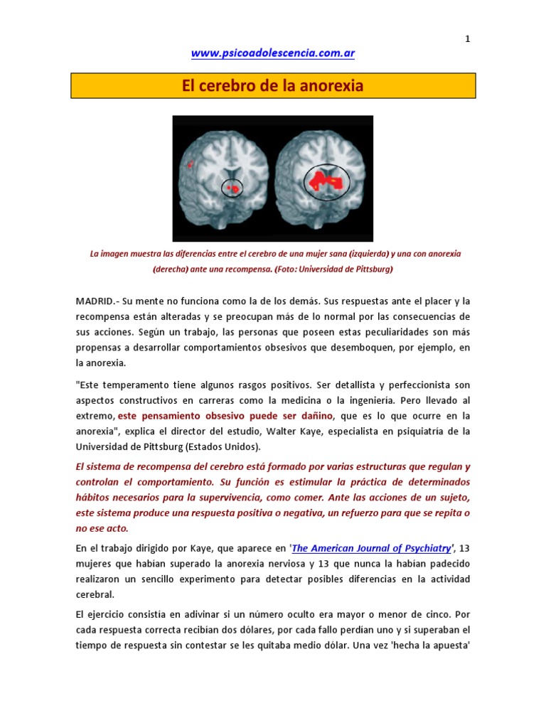 El Cerebro de La Anorexia | PDF | Anorexia nerviosa | Desorden alimenticio