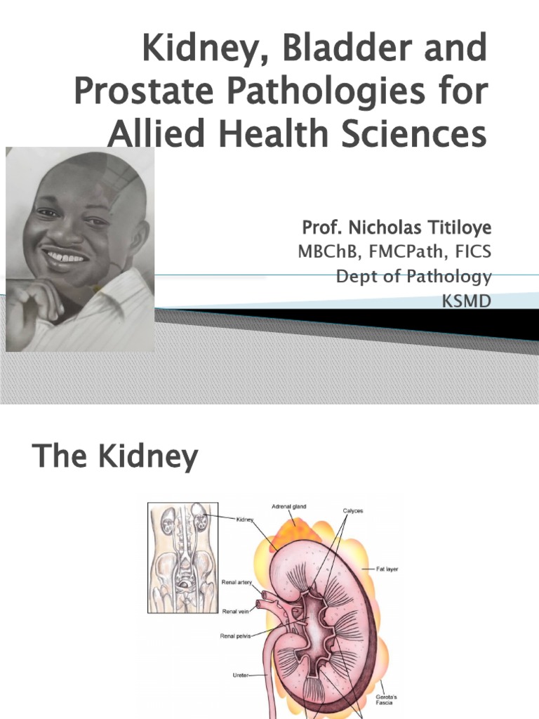 Kidney, Bladder and Prostate Pathology For Allied Health Sciences | PDF | Kidney | Prostate Cancer