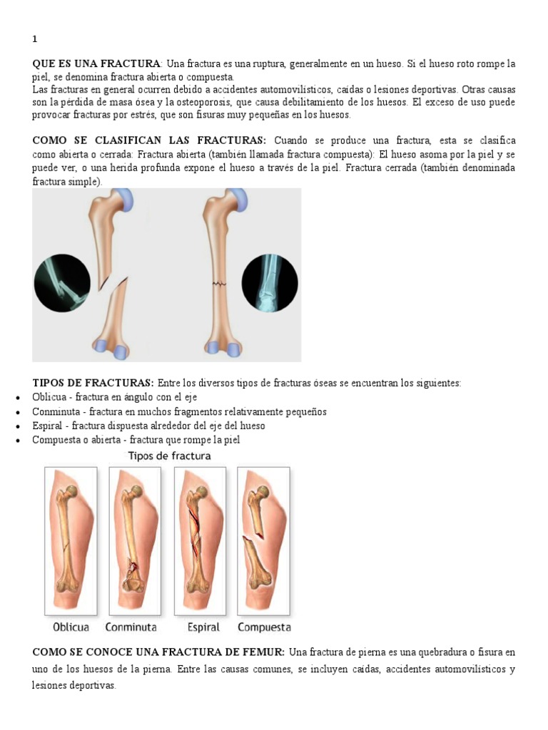 Hapkido | PDF | Hueso | Sistema musculoesquelético