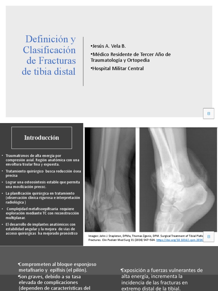 Definición y Clasificación de Fracturas de Tibia Distal | PDF | Sistema ...