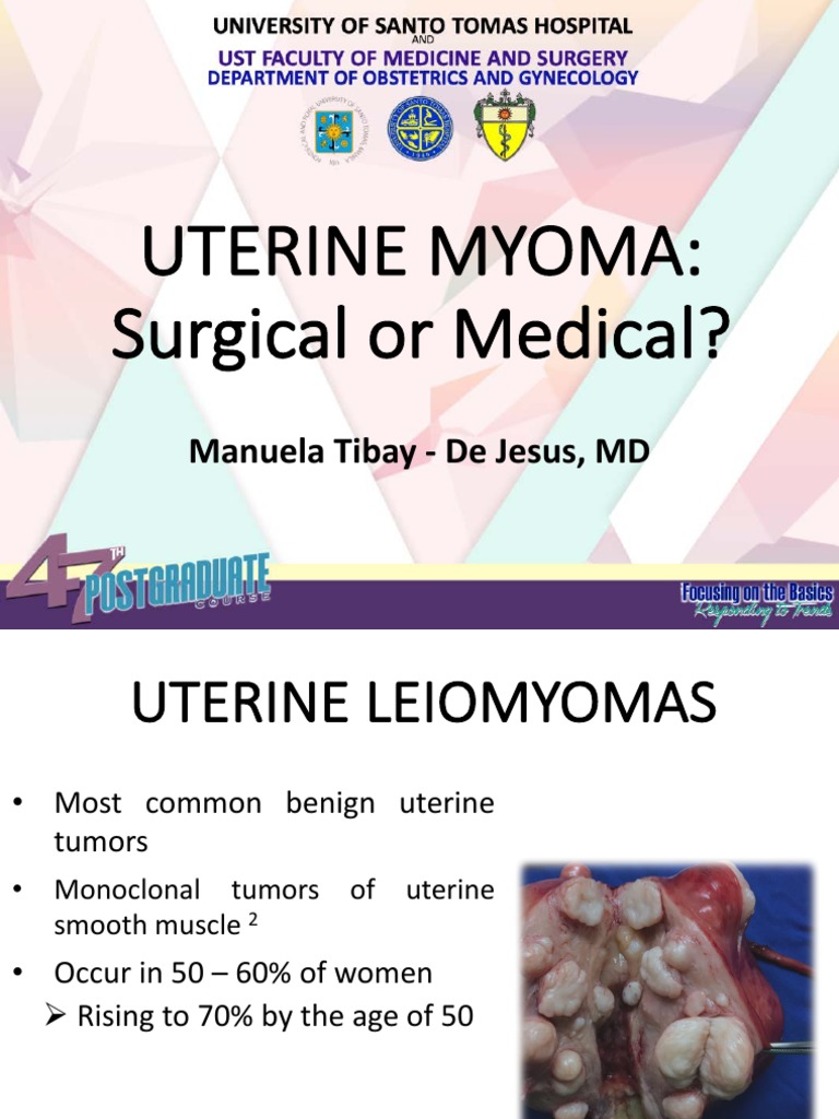 Uterine Myoma Management Options | PDF | Clinical Medicine | Health ...