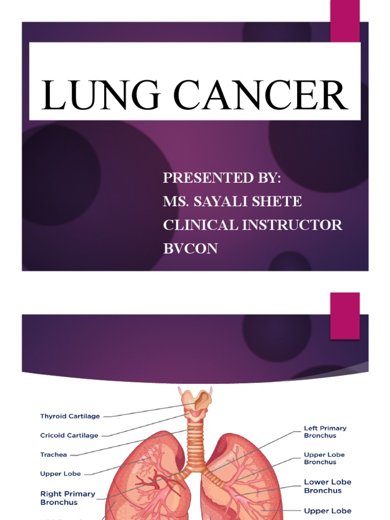 Lung Cancer | PDF | Lung Cancer | Cancer