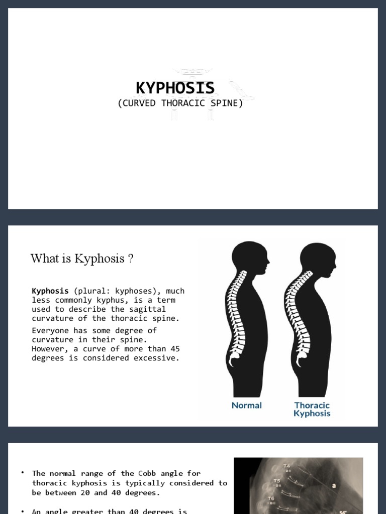 Kyphosis | PDF | Vertebral Column | Vertebra