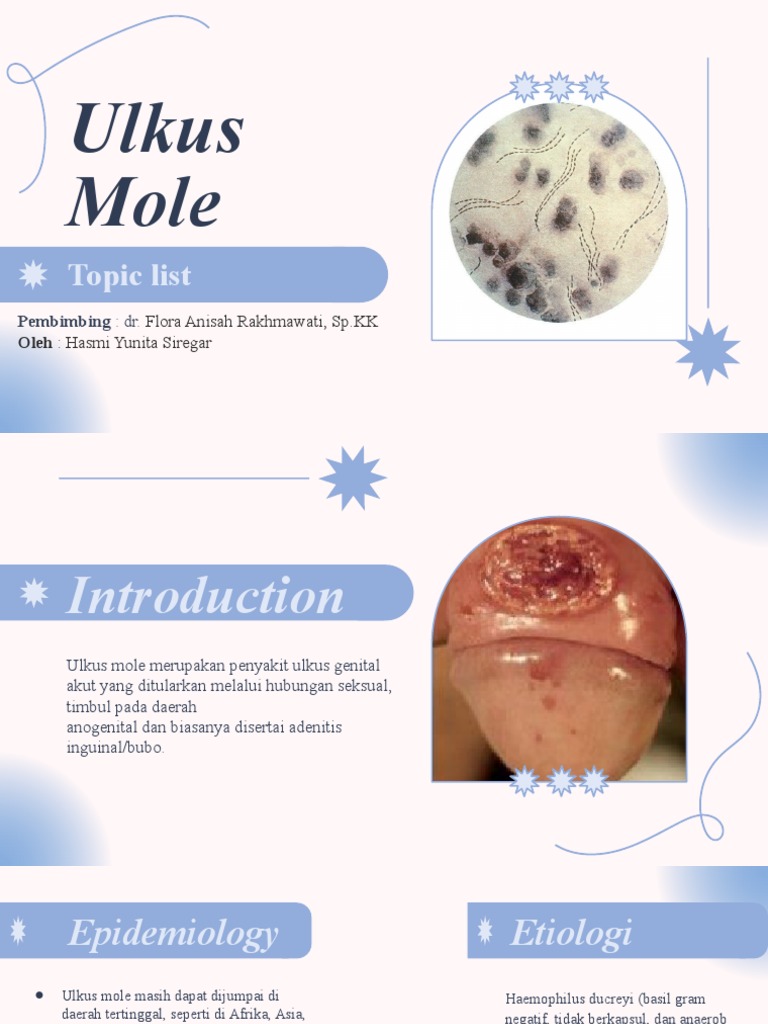 Ulkus Mole | PDF