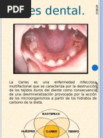 Etapas y Grados de Caries PDF | PDF | Diente | Odontología