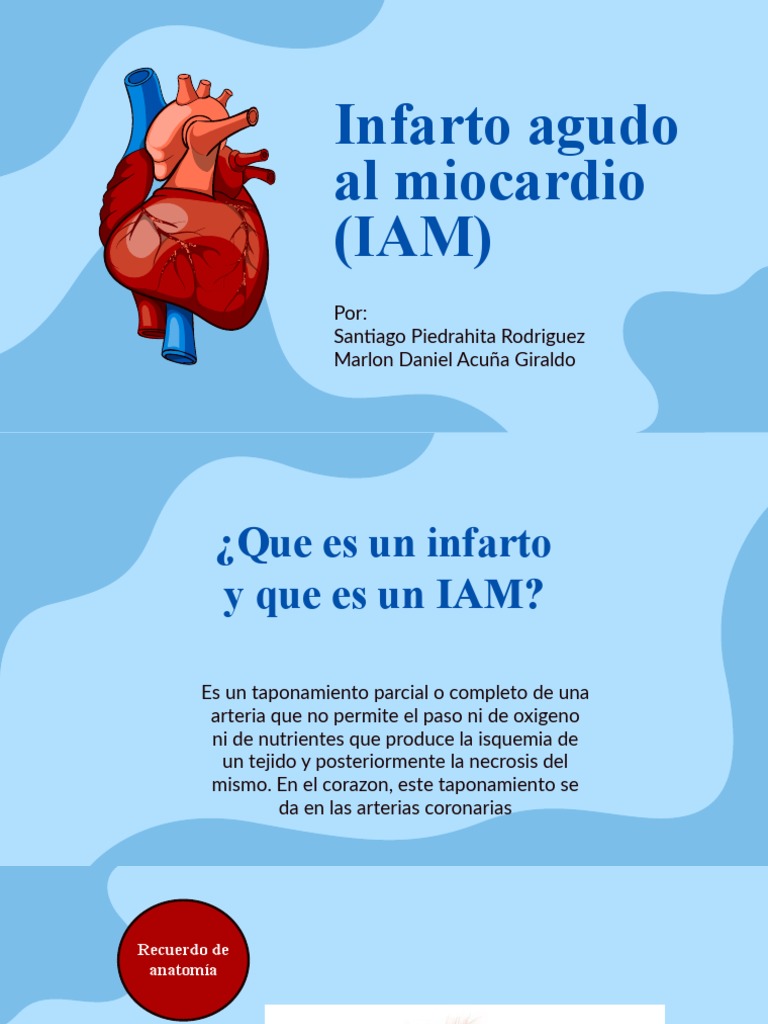 Iam | PDF | Infarto de miocardio | Epidemiología