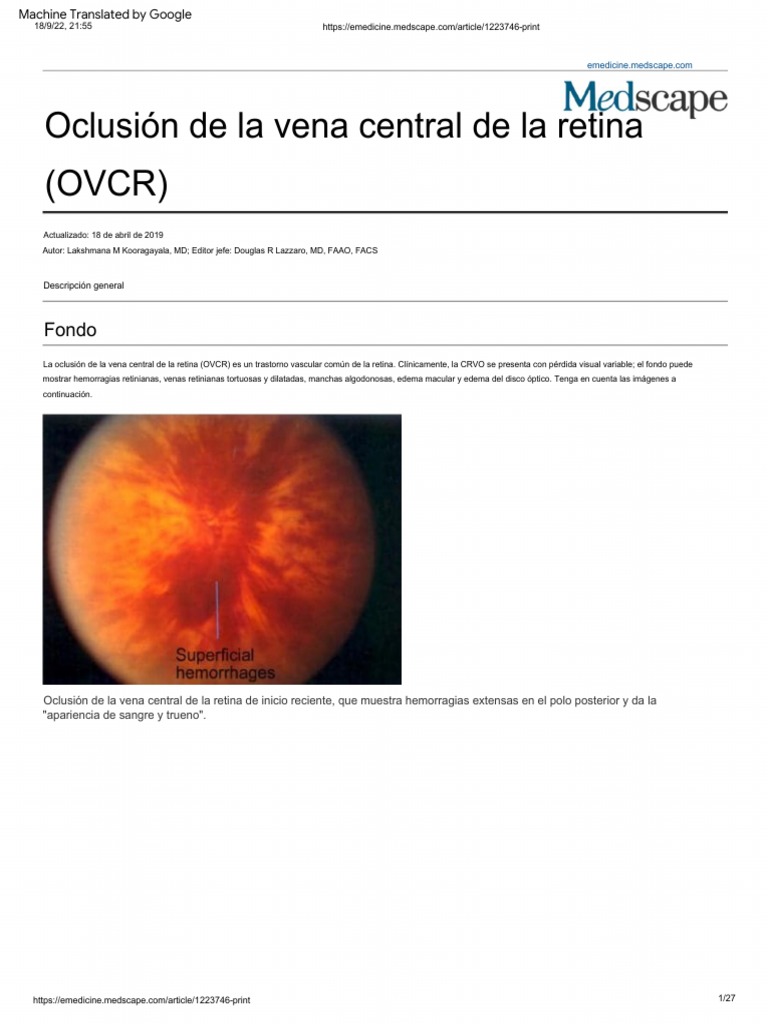 7.1 Central Vein Occlusion - Emedicine | PDF | Ojo humano | Factor de ...
