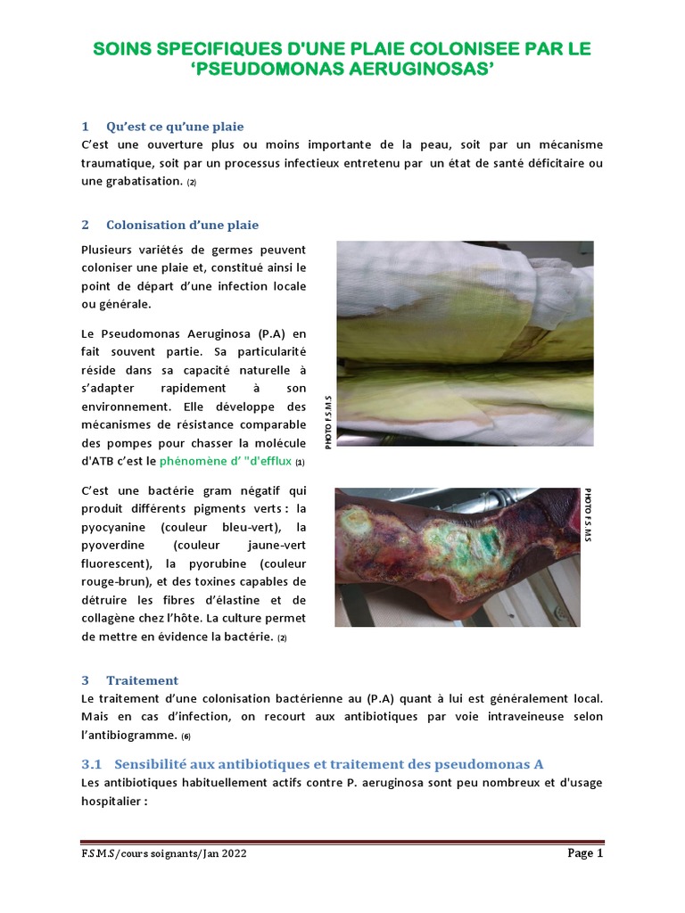 Soins Des Plaies À Base de Vinaigre PDF | PDF | Pseudomonas Aeruginosa ...