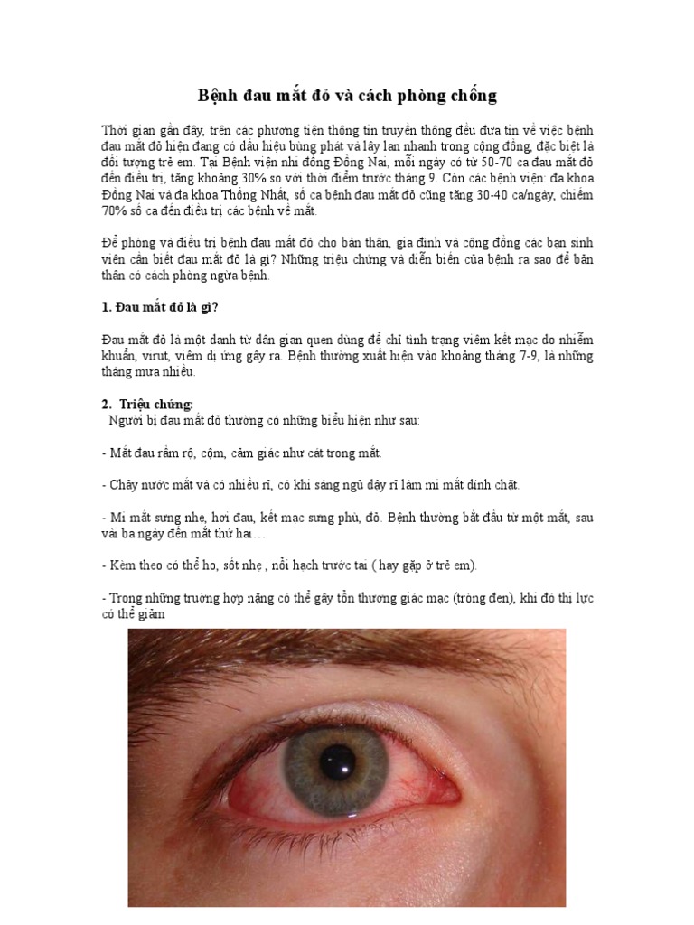 Benh Dau Mat Do Va Cach Phong Chong | PDF