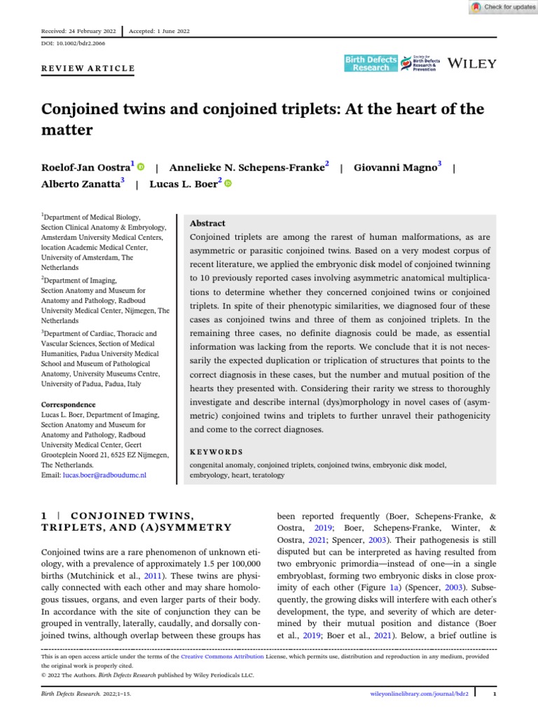 Understanding Conjoined Triplets | PDF | Twin | Heart