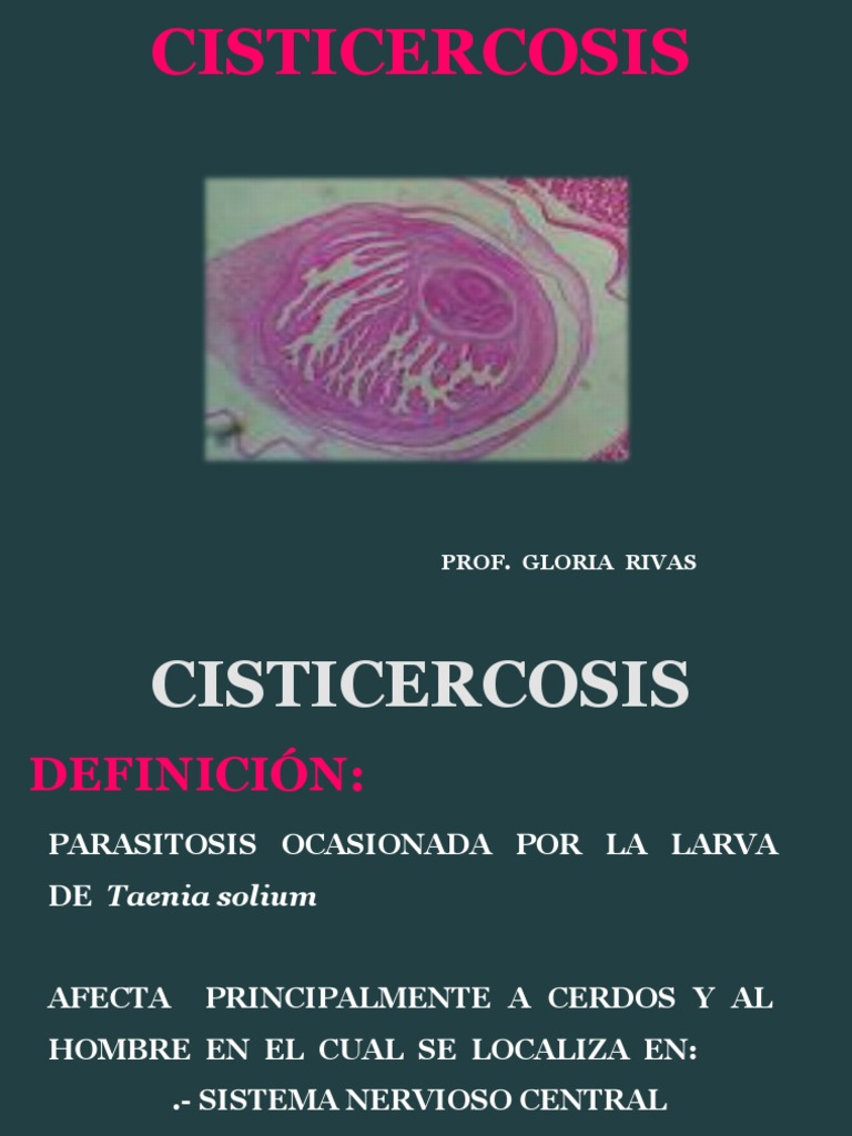 CISTICERCOSIS | PDF