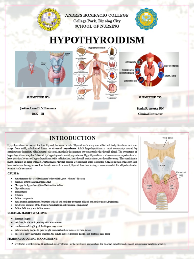 HYPOTHYROIDISM PATHOPHYSIOLOGY | PDF