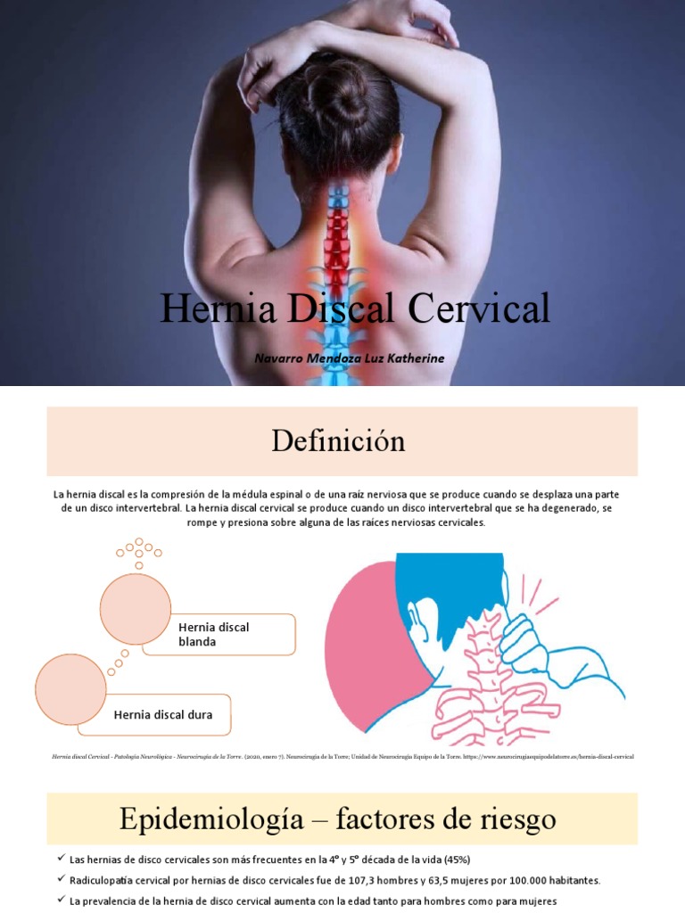 Hernia Discal Cervical: Diagnóstico y Tratamiento | PDF