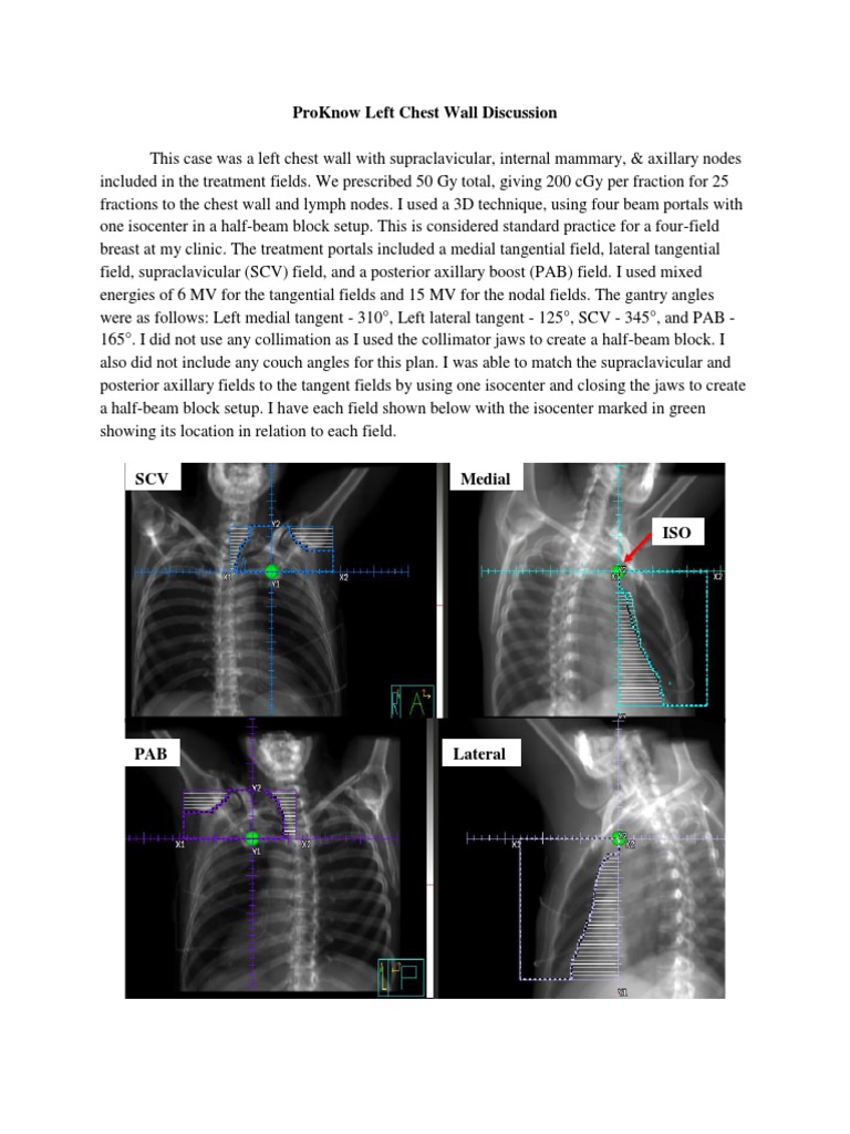 Proknow Left Chest Wall Discussion | Download Free PDF | Heart ...