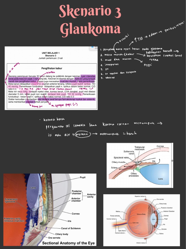 Skenario 3 Glaukoma | PDF